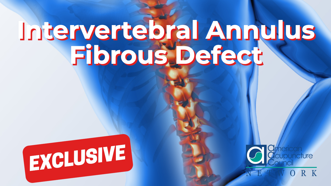 Billing And Coding Intervertebral Annulus Fibrous Defect Aac Info Network